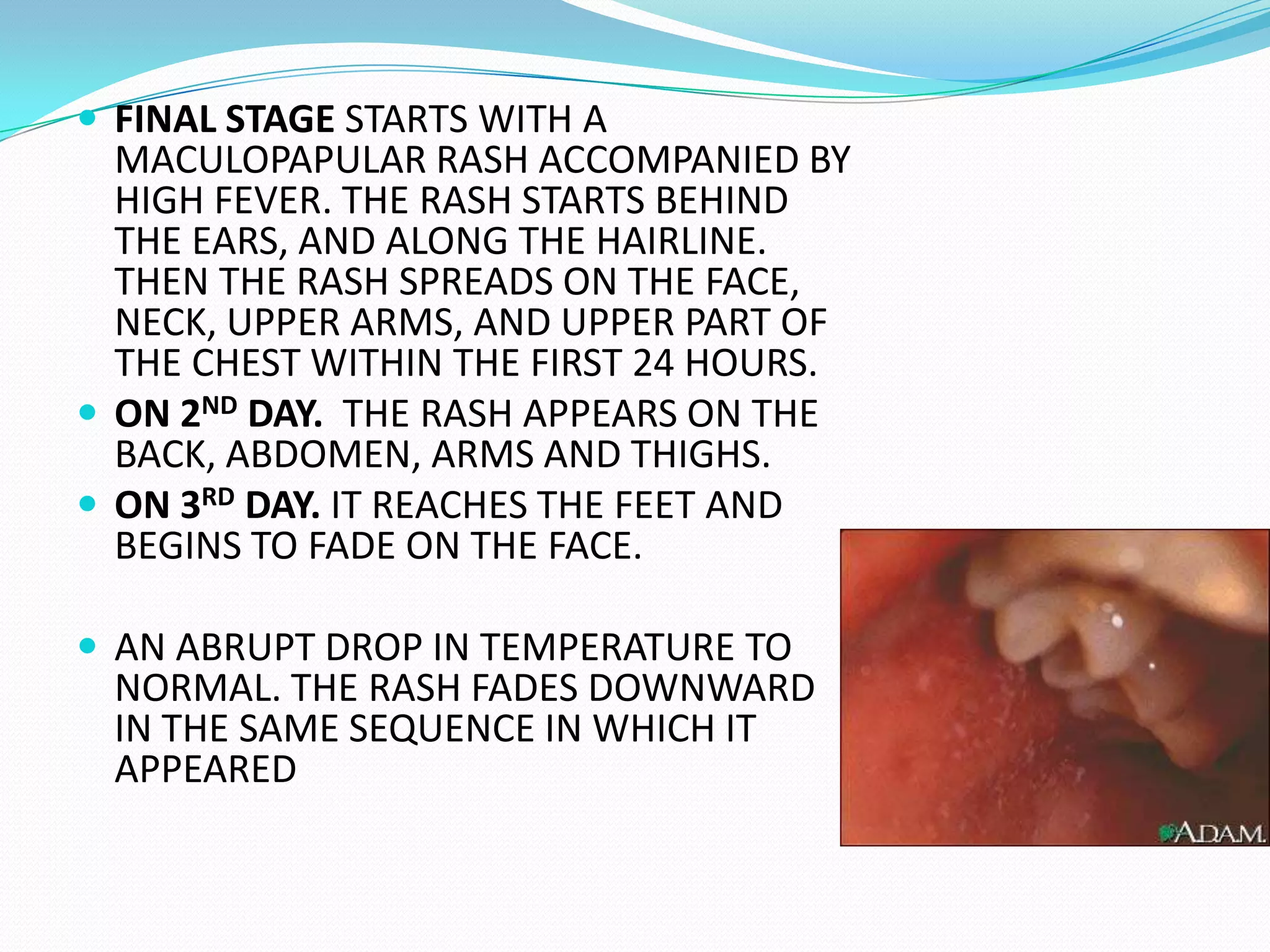 Approach to fever with rashes | PPTX