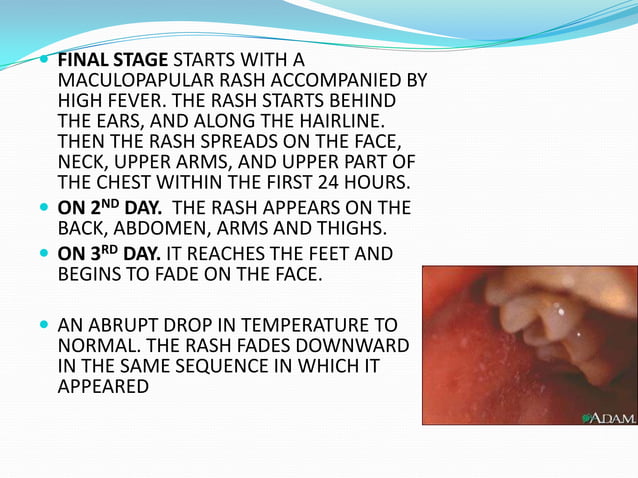 Approach to fever with rashes | PPTX | Skin and Dermatology | Diseases and Conditions