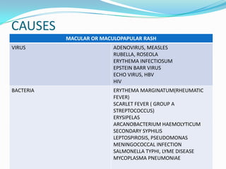 Approach to fever with rashes | PPTX