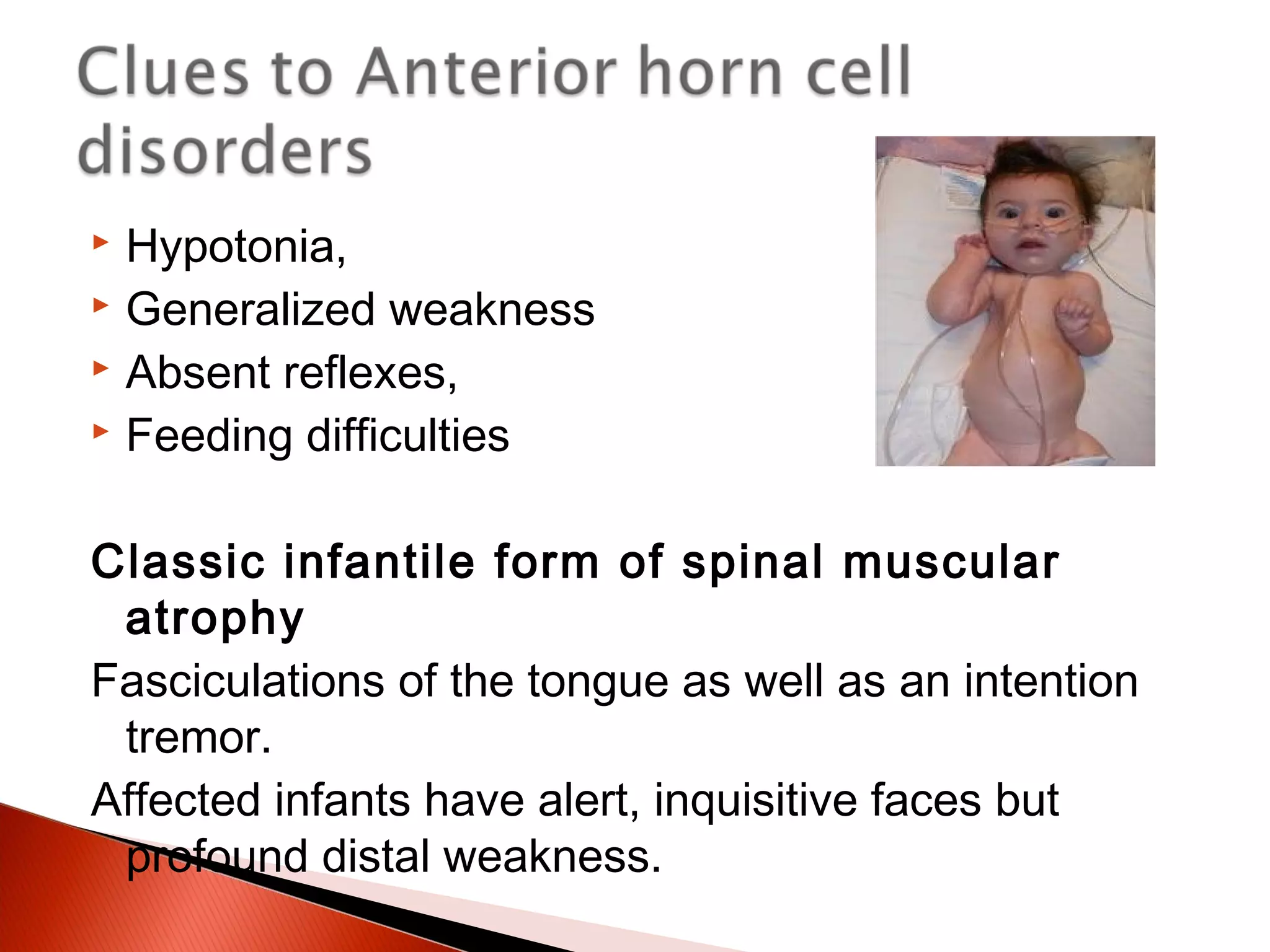 Approach to floppy infant ppt | PPT