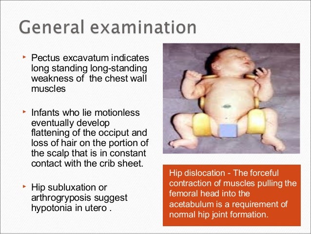 Approach to floppy infant ppt