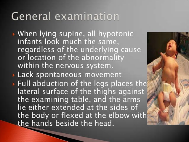 Approach to floppy infant | PPTX | Pregnancy | Reproductive Health