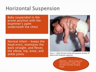 Approach to floppy infant | PPTX