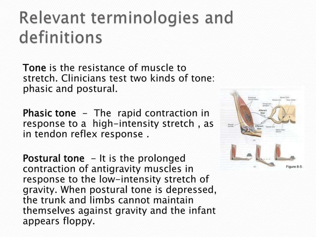 Approach to floppy infant | PPTX | Pregnancy | Reproductive Health
