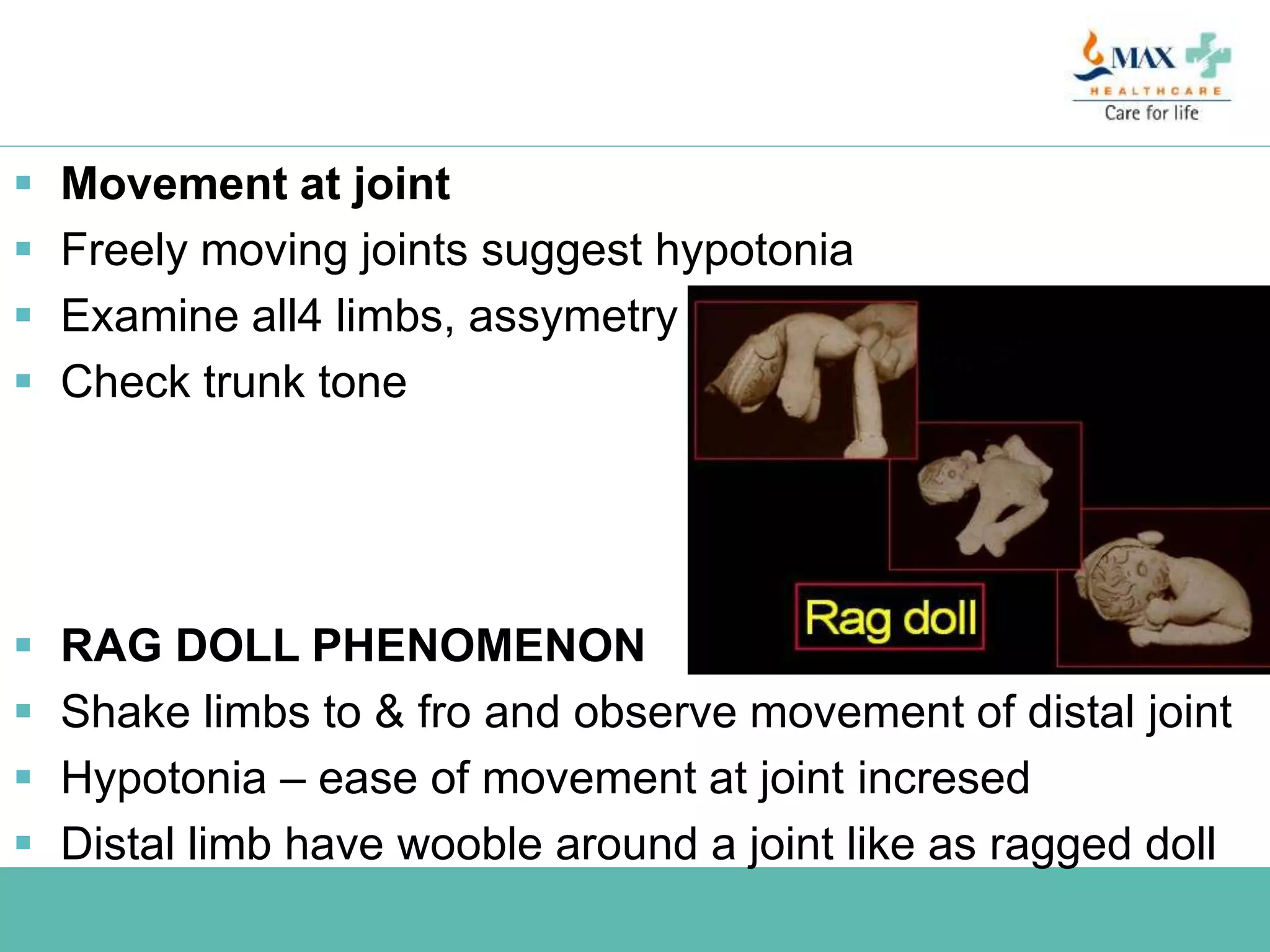 Approach to floppy infant | PPTX