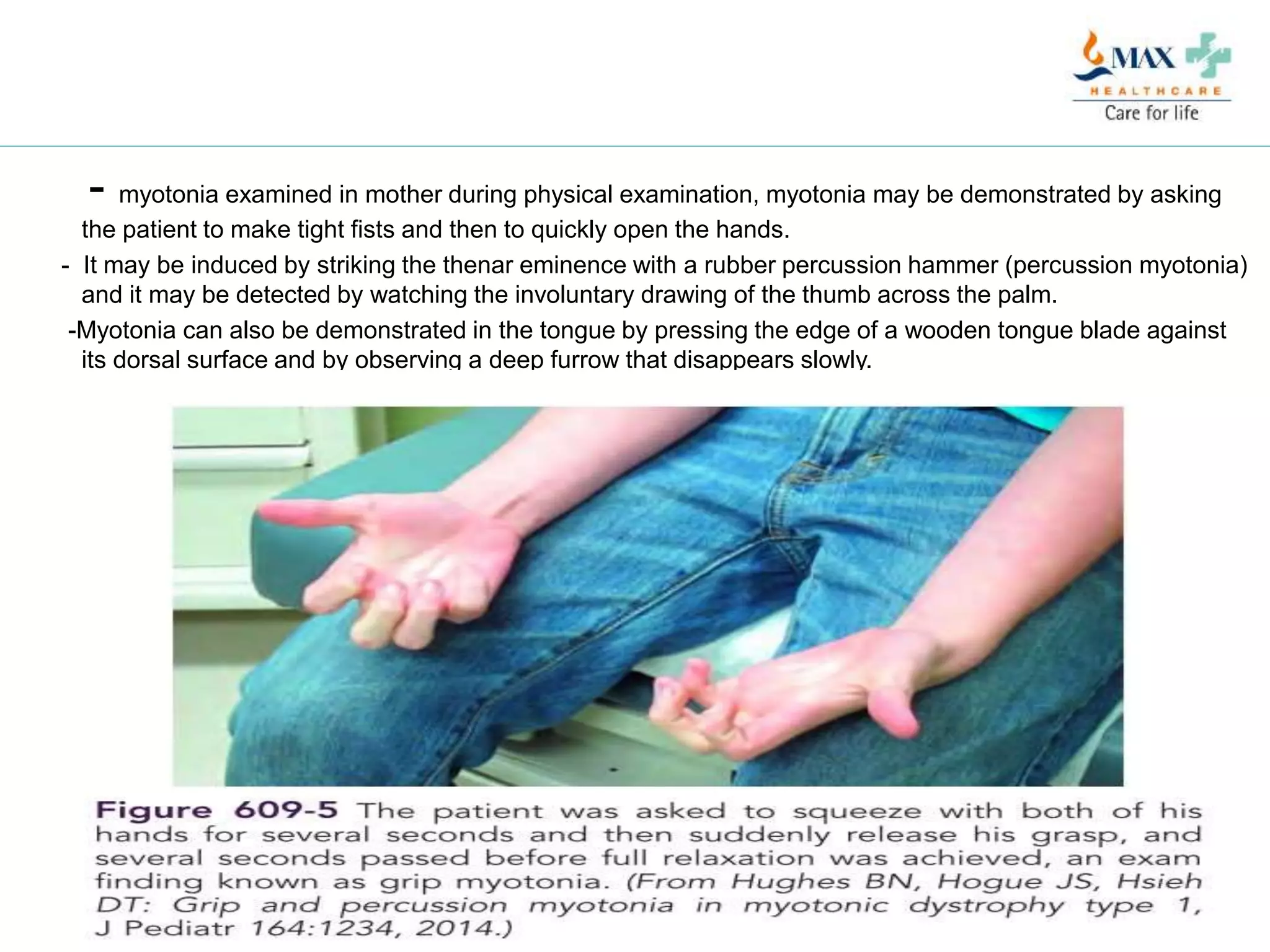 Approach to floppy infant | PPTX