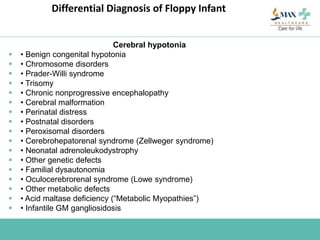 Approach to floppy infant | PPTX