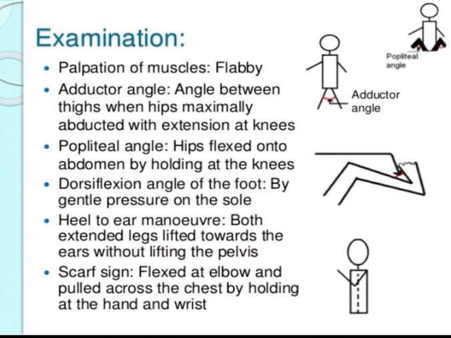 Approach to floppy infant | PPTX | Brain and Nervous System Disorders ...