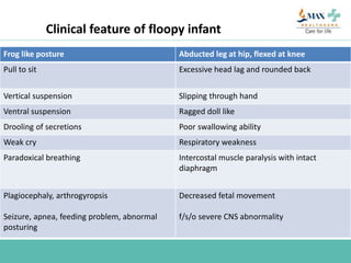 Approach to floppy infant | PPTX