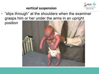 Approach to floppy infant | PPT