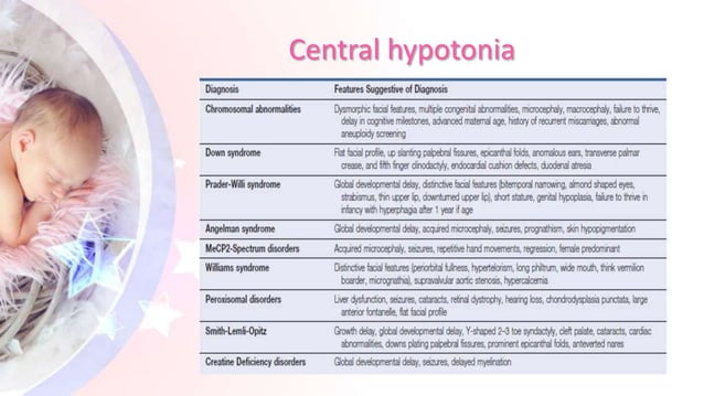 Approach to floppy infant | PPTX | Brain and Nervous System Disorders ...