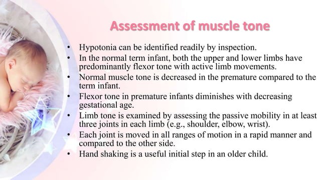 Approach to floppy infant | PPTX | Brain and Nervous System Disorders ...