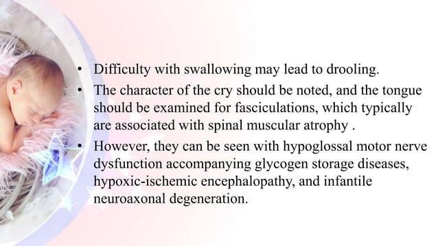Approach to floppy infant | PPTX | Brain and Nervous System Disorders ...
