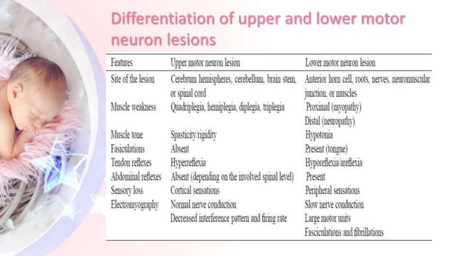 Approach to floppy infant | PPTX | Brain and Nervous System Disorders ...