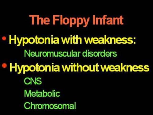 Approach to Floppy Infant.ppt