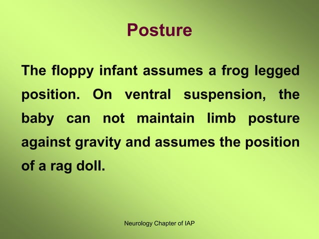 Approach to Floppy Infant.ppt