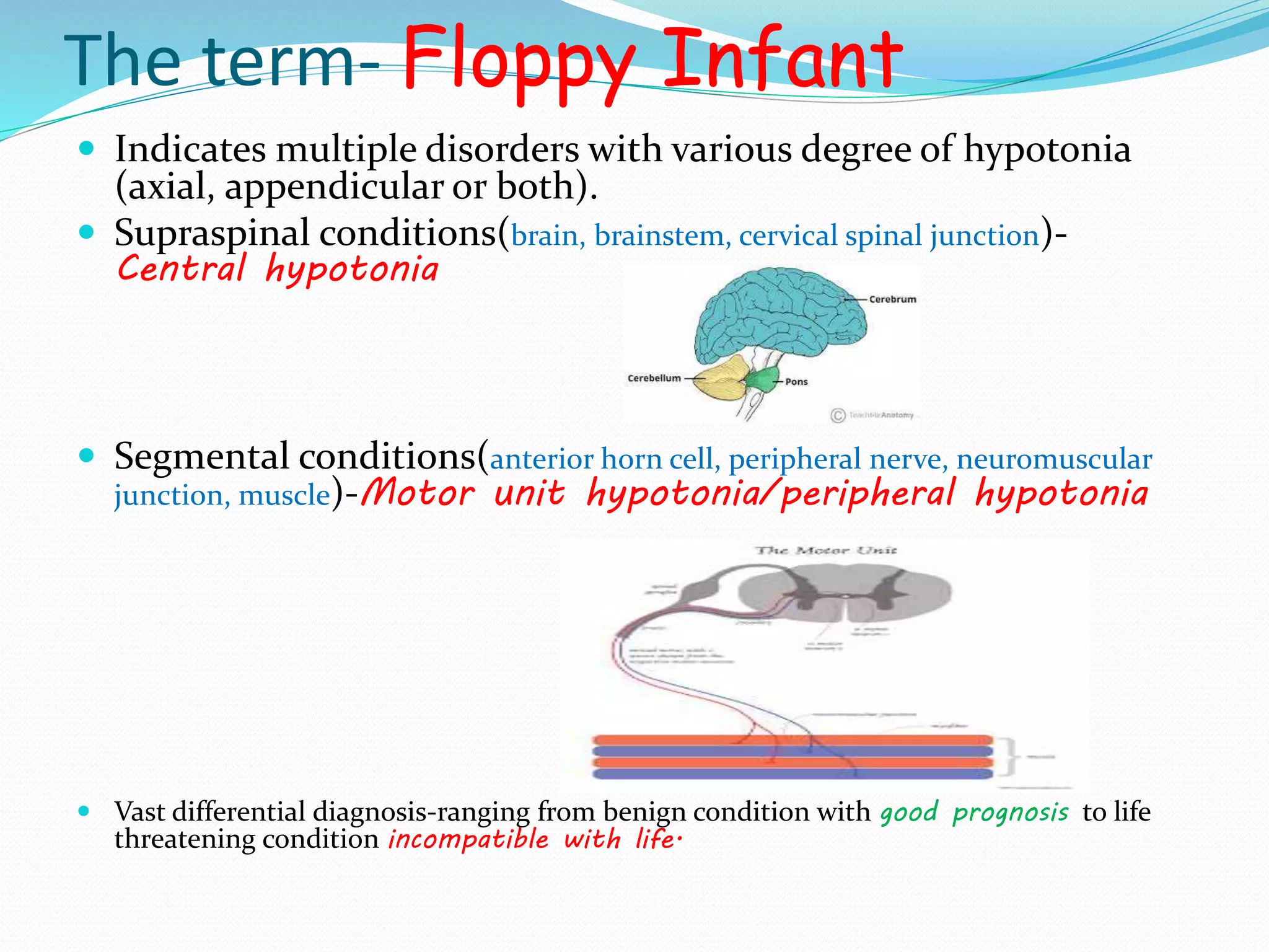 Approach_to_floppy_infant__1_.pptx