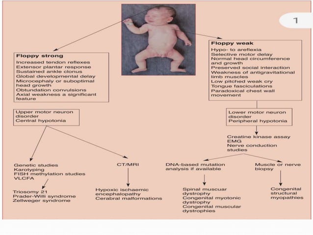 Approach_to_floppy_infant__1_.pptx