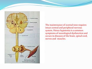 Approach_to_floppy_infant__1_.pptx