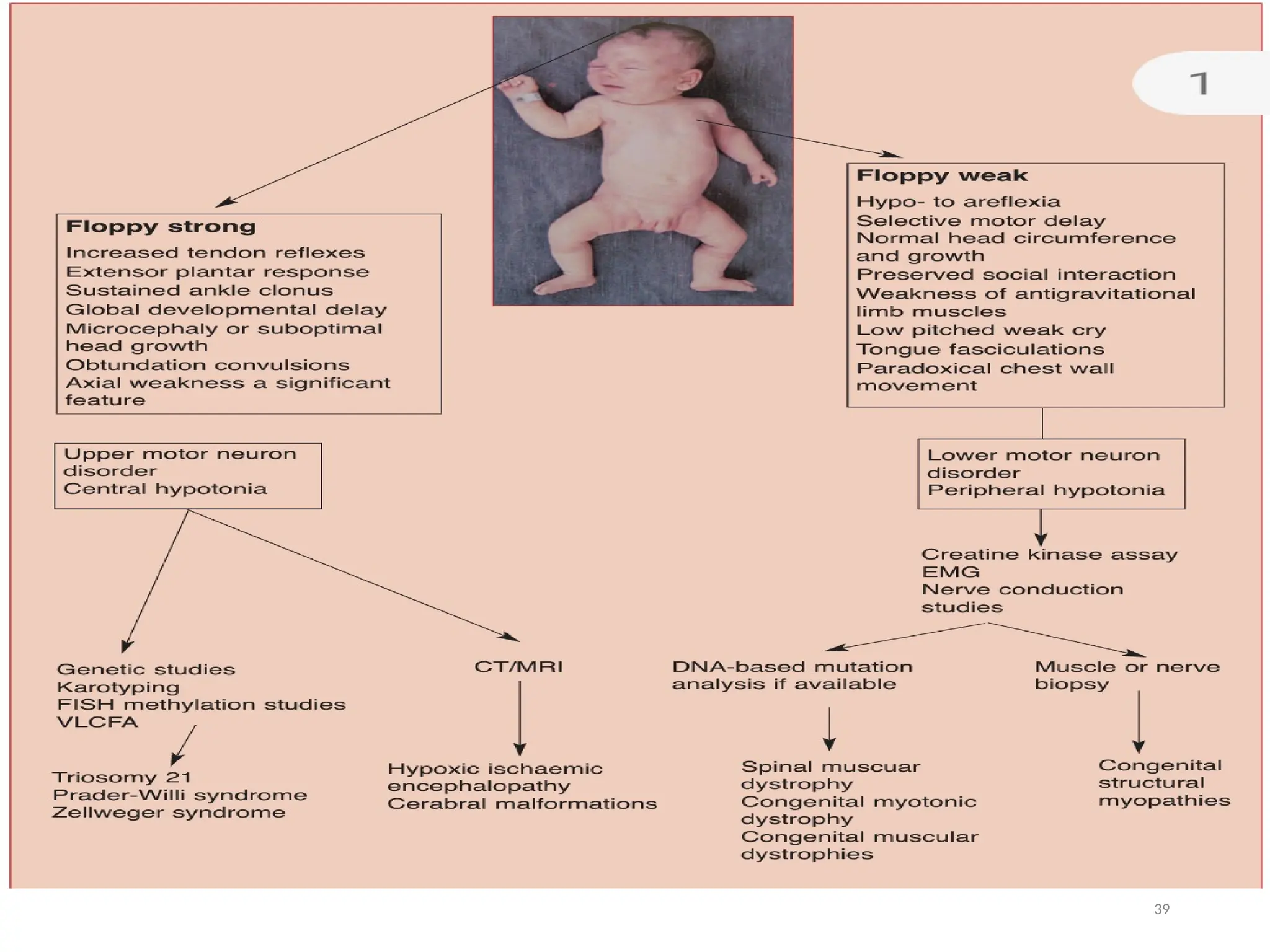 Approach_to_floppy_infant_presentation_slides | PPTX