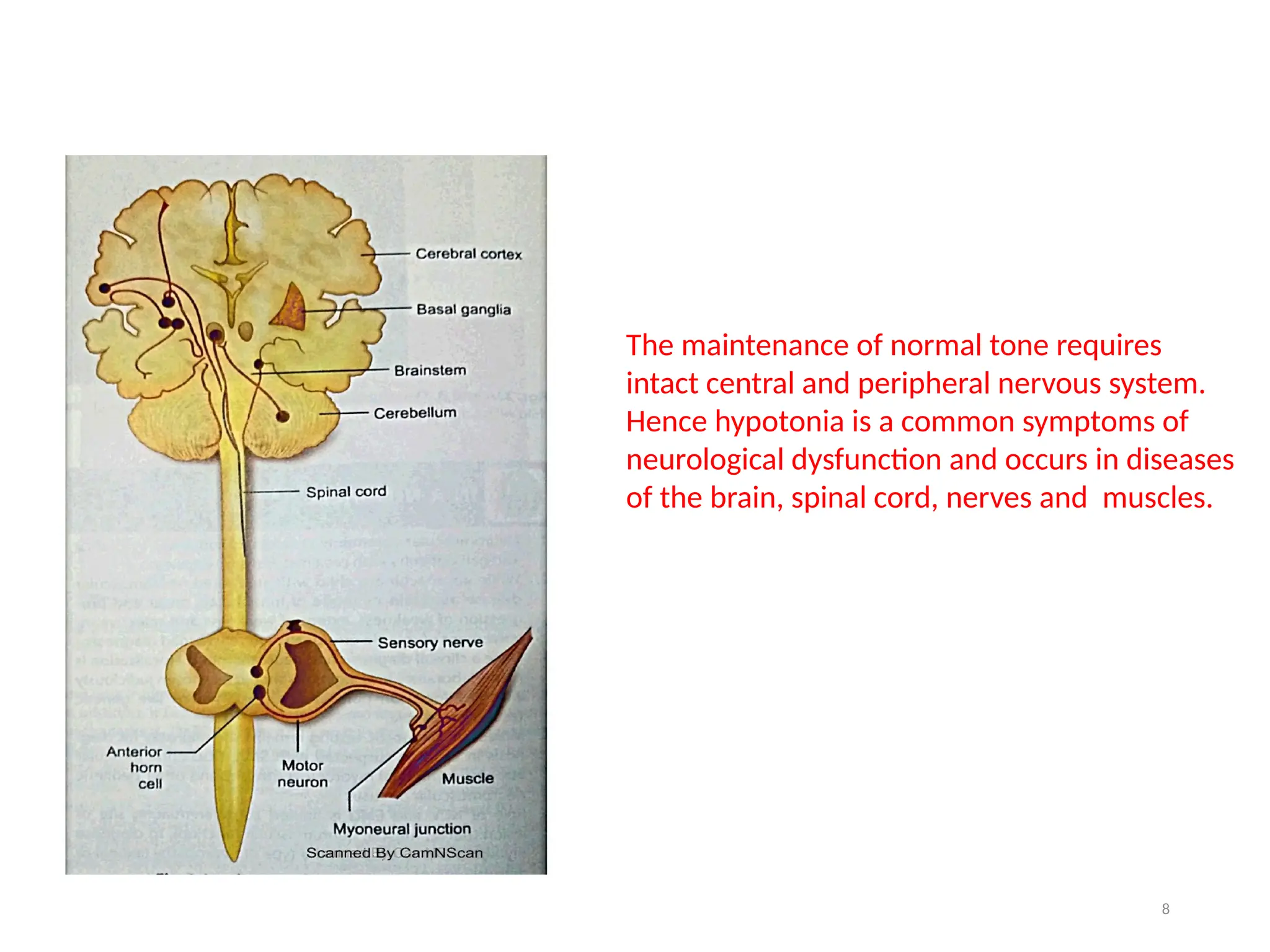 Approach_to_floppy_infant_presentation_slides | PPTX