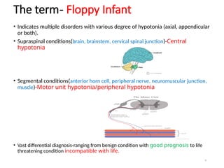 Approach_to_floppy_infant_presentation_slides | PPTX
