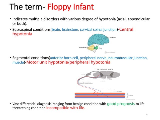 Approach_to_floppy_infant_presentation_slides | PPT