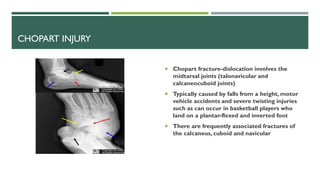 Approach to foot x ray.pdf