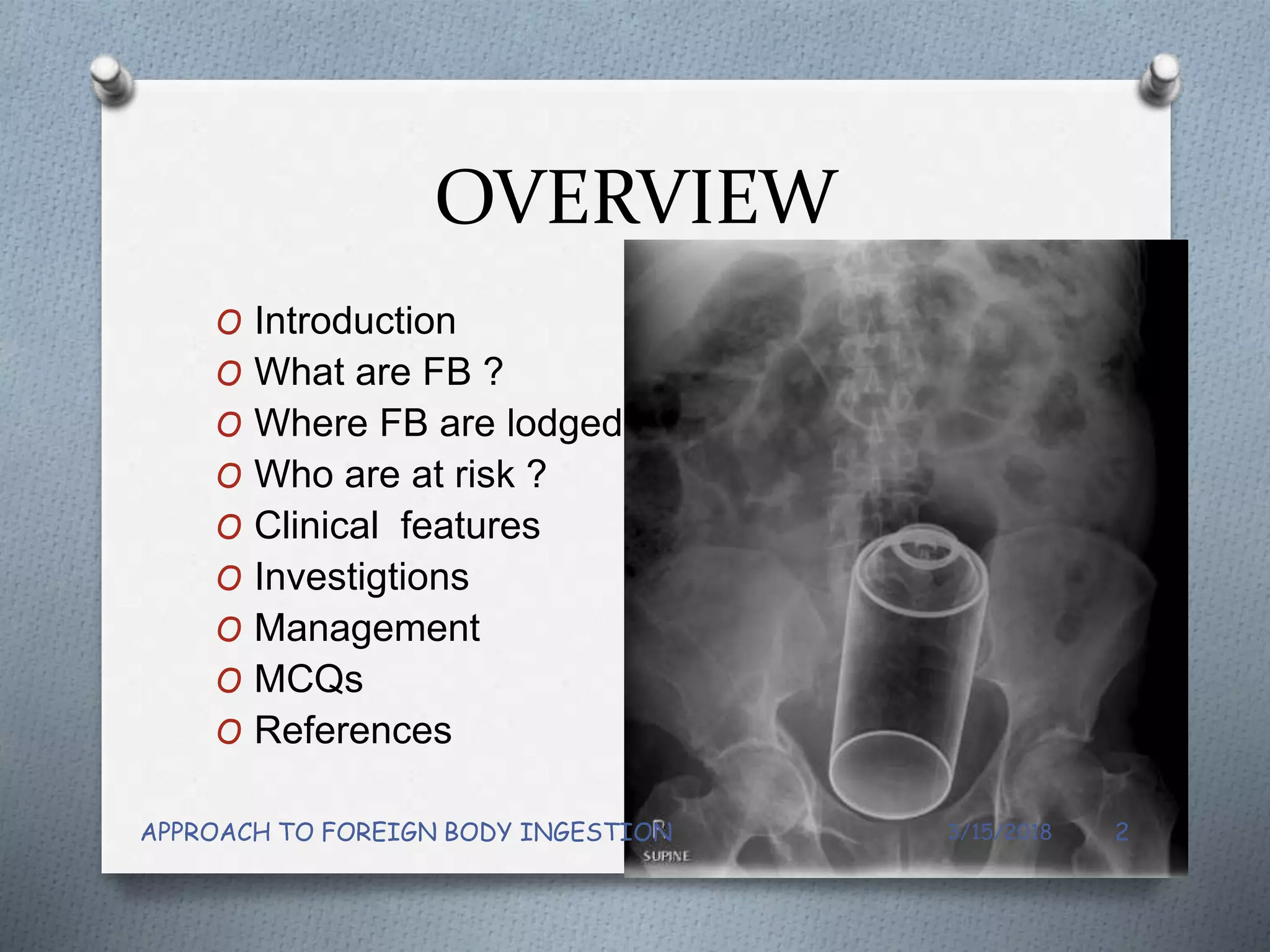 Approach to foreign body ingestion | PPTX