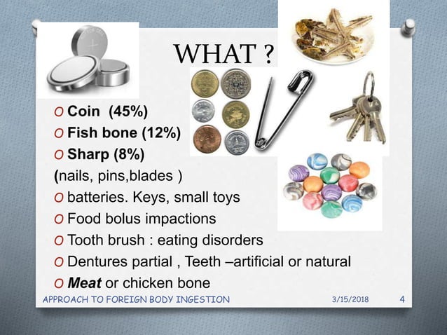 Approach to foreign body ingestion | PPTX