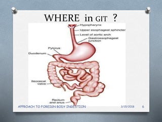 Approach to foreign body ingestion | PPTX