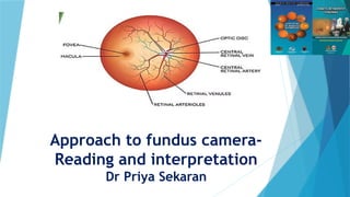 Approach to fundus camera- Reading and interpretation 2.pptx