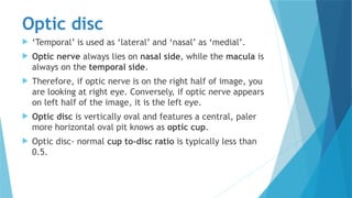 Approach to fundus camera- Reading and interpretation 2.pptx