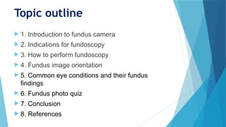 Approach to fundus camera- Reading and interpretation 2.pptx