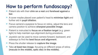Approach to fundus camera- Reading and interpretation 2.pptx