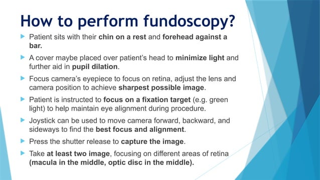 Approach to fundus camera- Reading and interpretation 2.pptx