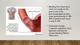 APPROACH TO GASTRO-INTESTINAL BLEEDING 2.pptx