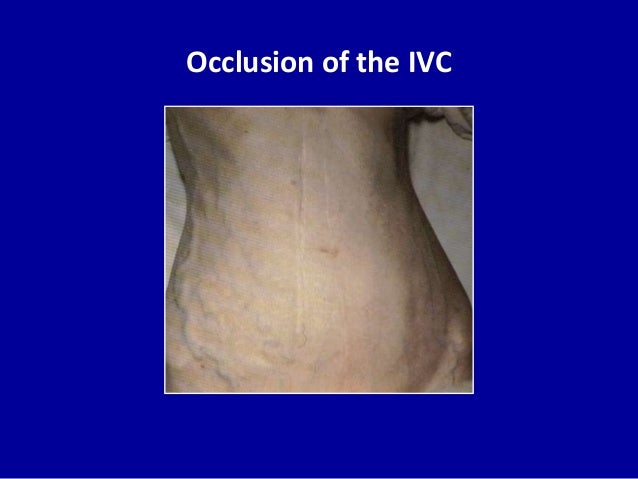 Approach to gastrointestinal bleeding