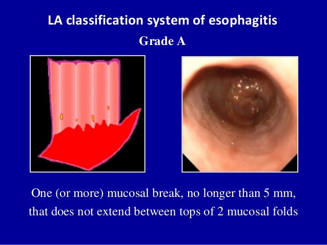 Approach to gastrointestinal bleeding