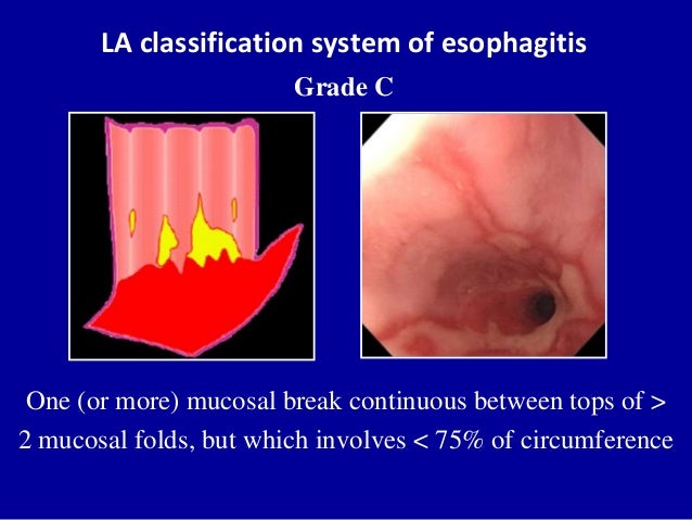 Approach to gastrointestinal bleeding