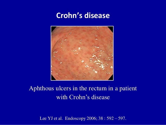 Approach to gastrointestinal bleeding