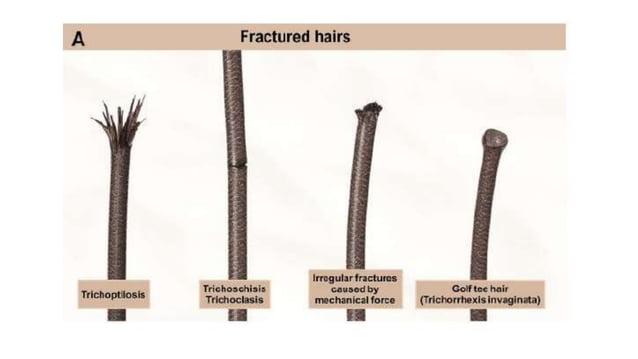 Approach to hair shaft disorders | PPTX | Hair Care | Beauty