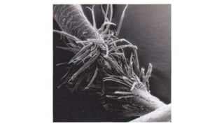 Approach to hair shaft disorders | PPTX