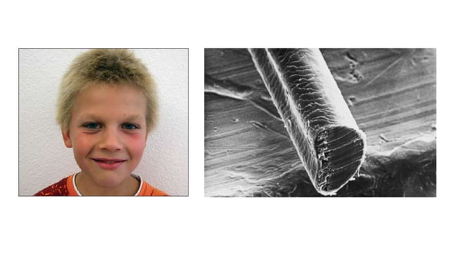 Approach to hair shaft disorders | PPTX | Hair Care | Beauty