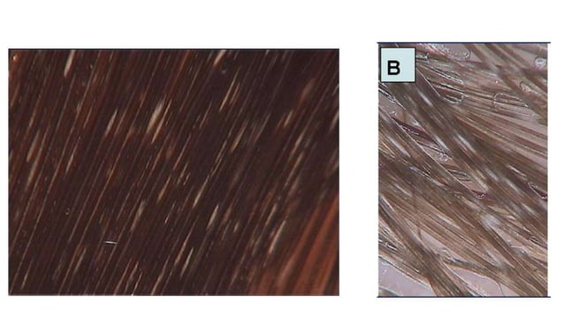 Approach to hair shaft disorders | PPTX | Hair Care | Beauty