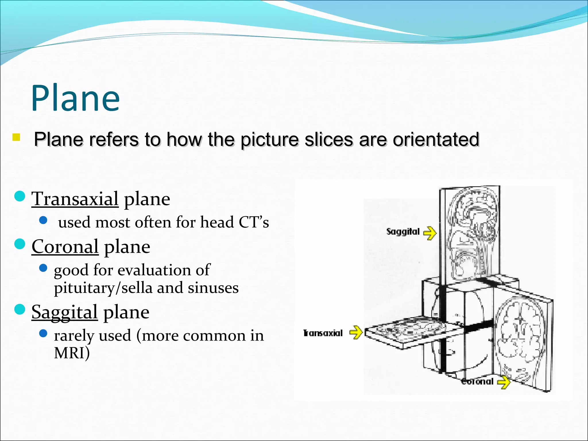 Approach to head ct | PPT