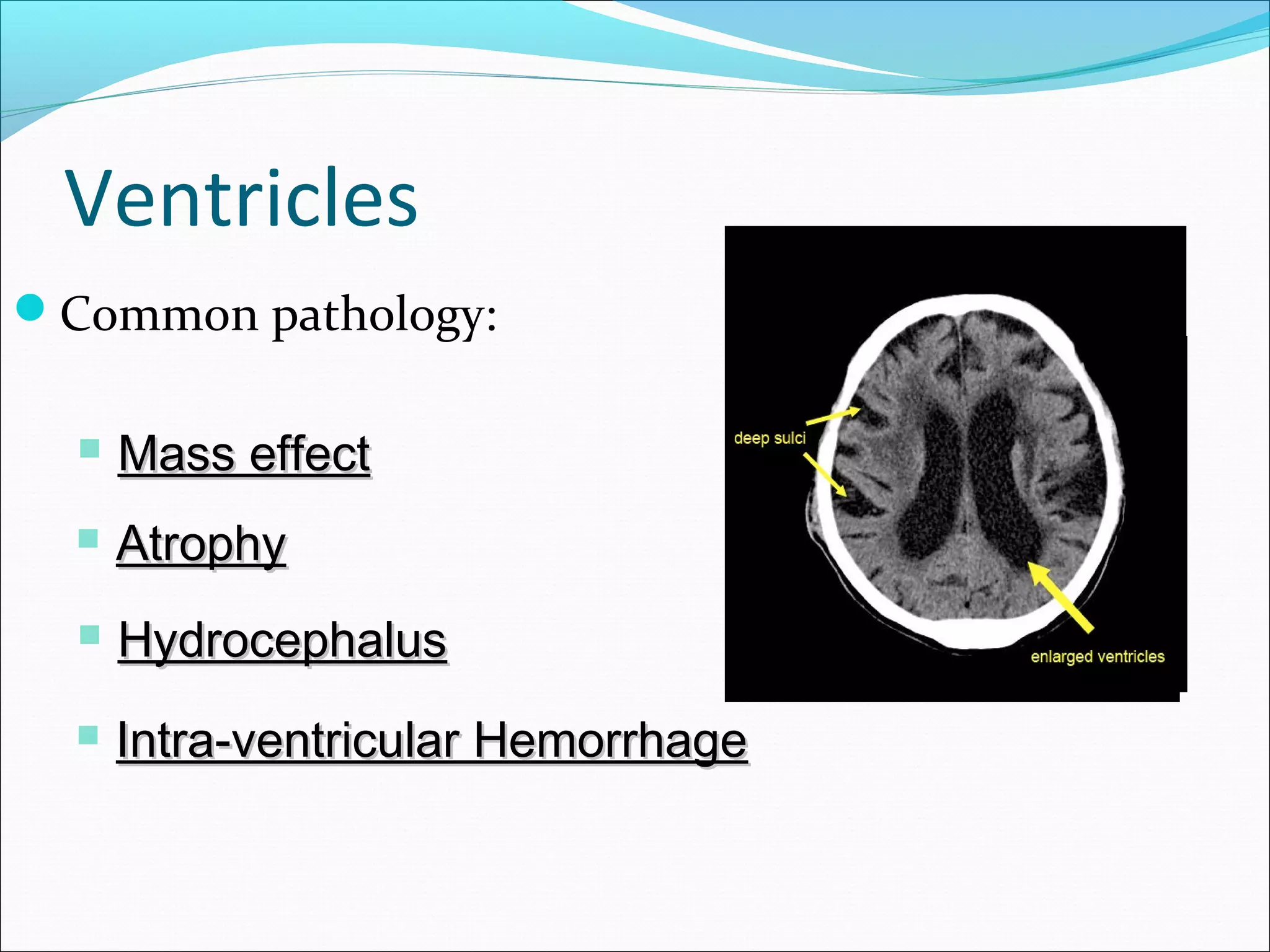 Approach to head ct | PPT