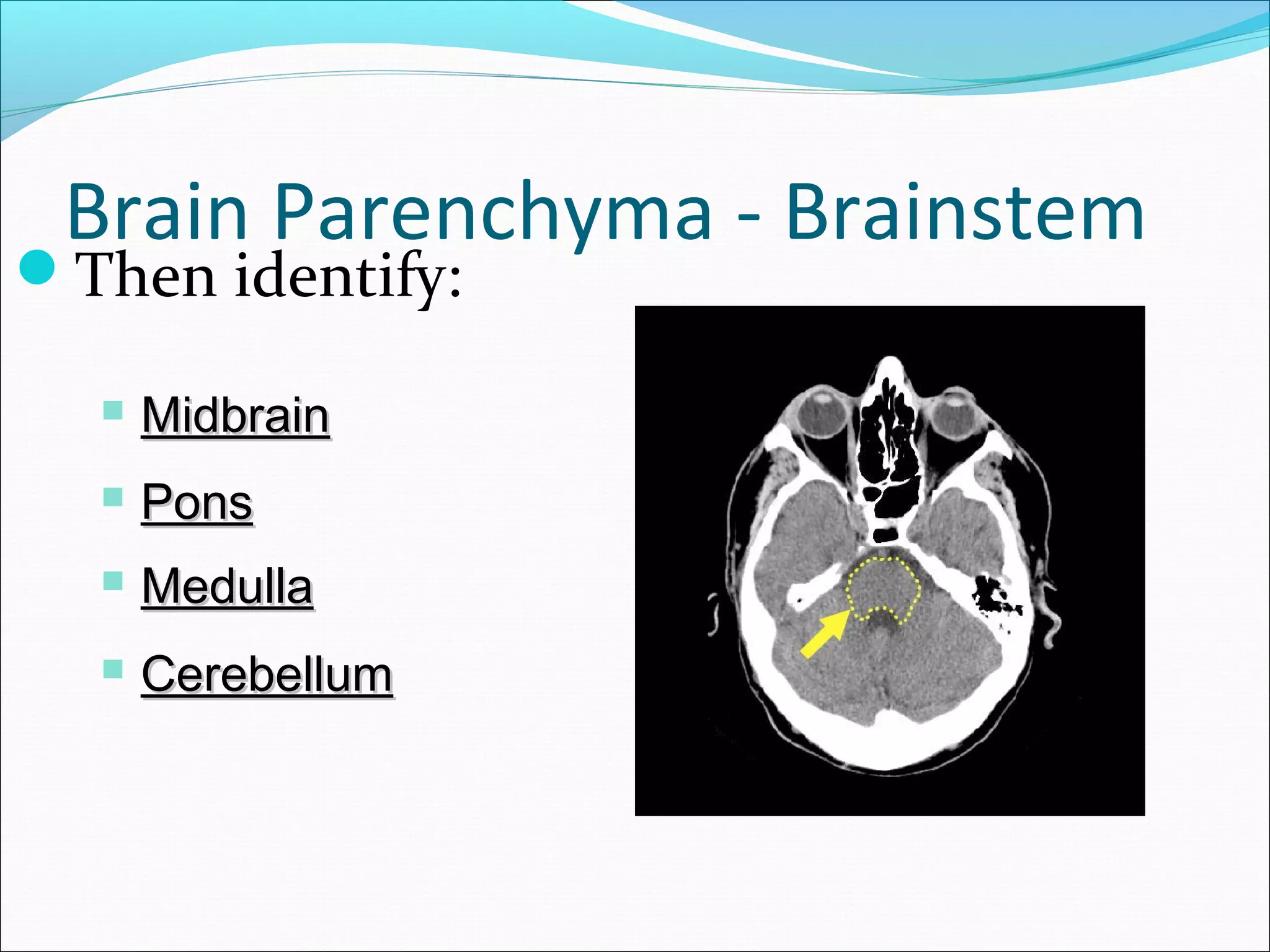 Approach to head ct | PPT