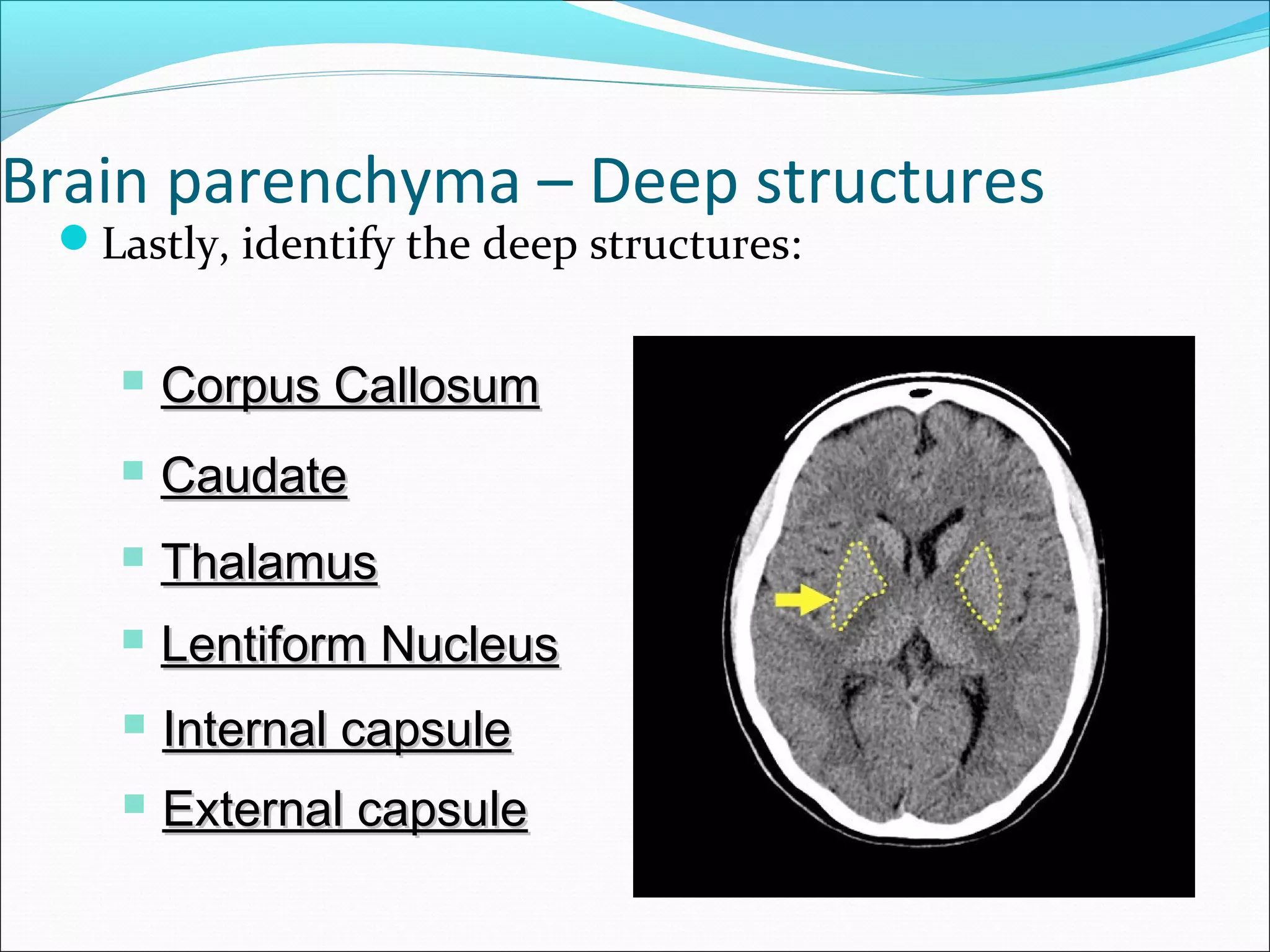 Approach to head ct | PPT