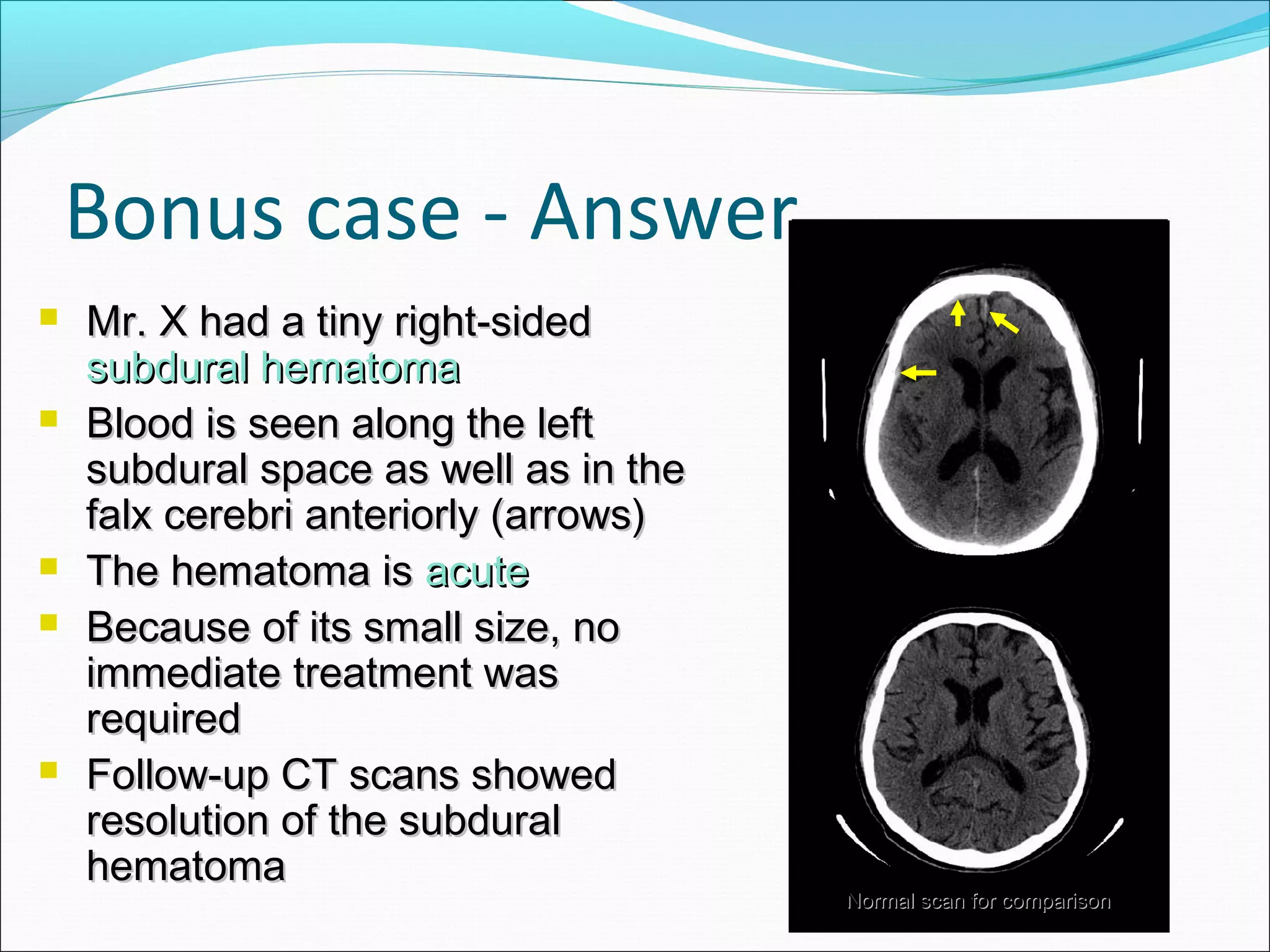 Approach to head ct | PPT